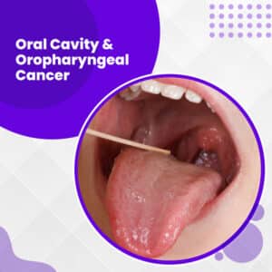 Oral Cavity and Oropharyngeal Cancer , Signs and Symptoms | Uhapo