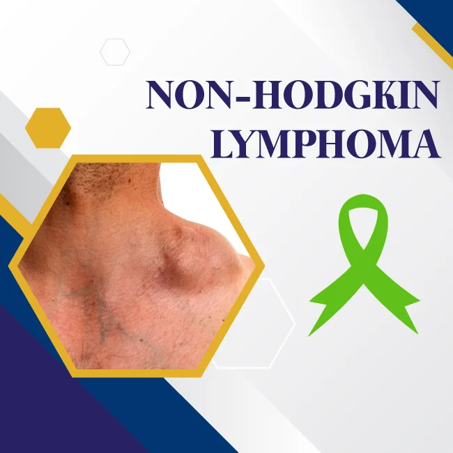 Non-Hodgkin Lymphoma - UHAPO